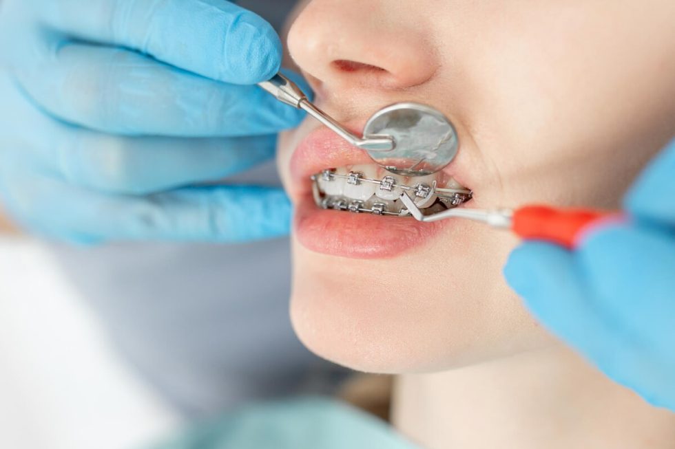 What is Orthodontics?: Exploring the Purpose and Practice